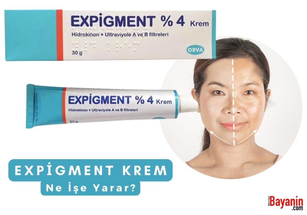 Expigment Krem Ne İşe Yarar? Nasıl Kullanılır?